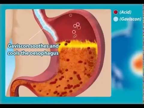GAVISCON Cool Liquid 300ml – Matakana Pharmacy